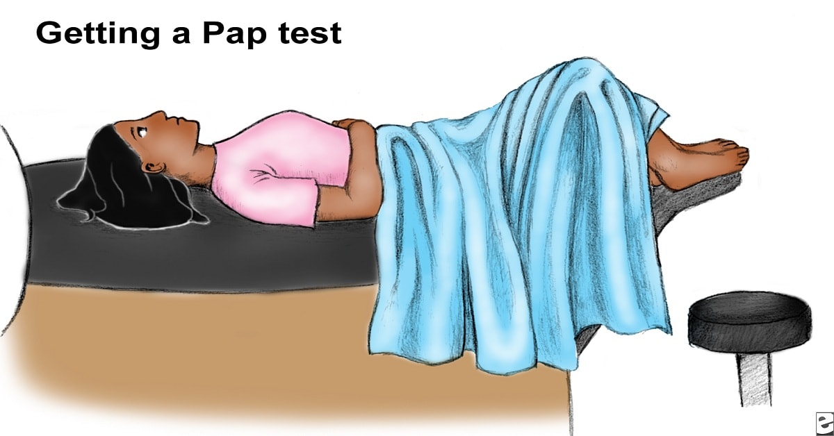 Pap smear test